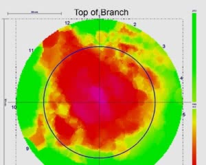 Arbotom® 2D/3D Sonic Tree Tomography - RINNTECH